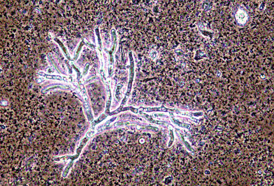 Chapitre 28: Aspergilloses et autres champignons filamenteux opportunistes