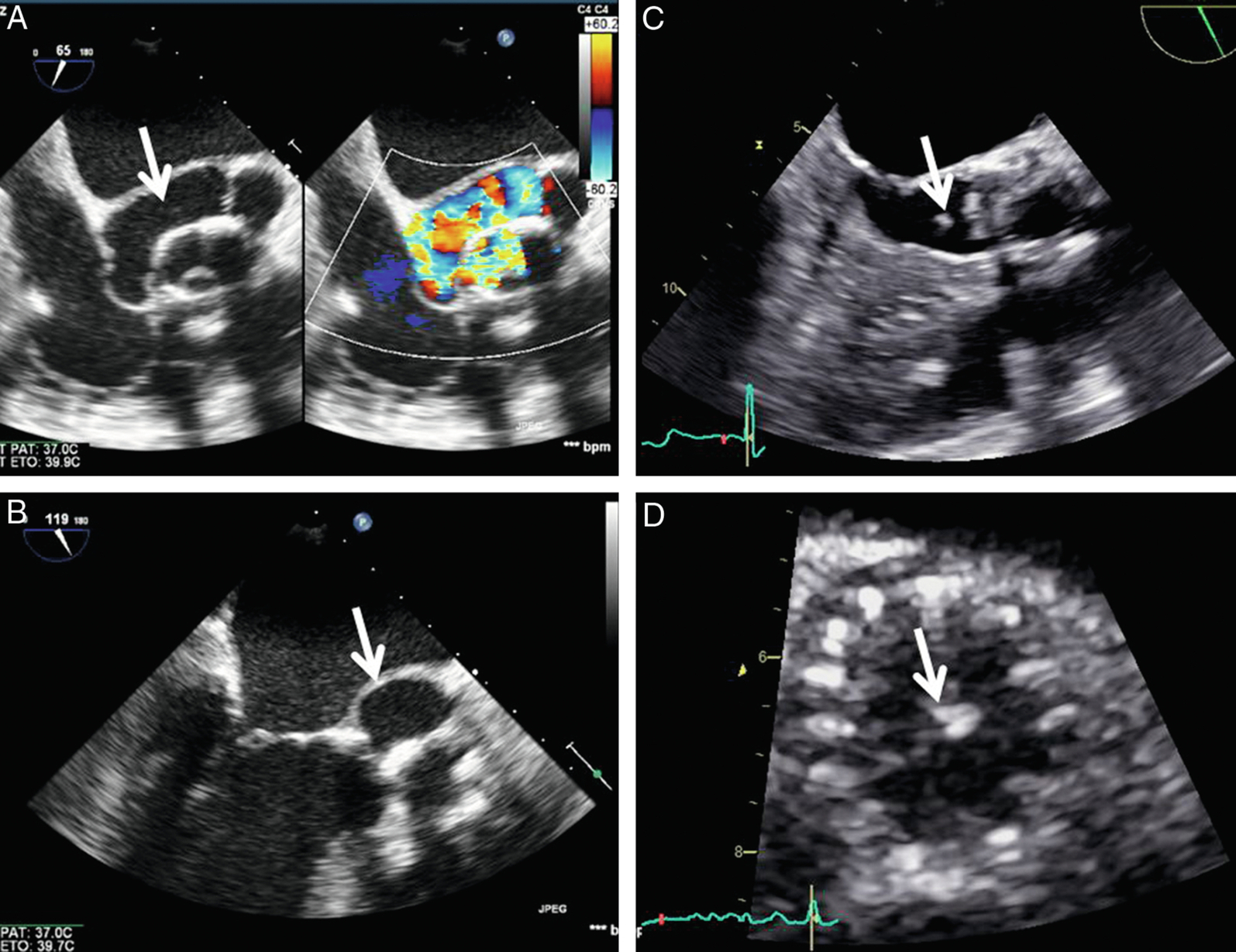 Chapitre 10: Item 153 Surveillance des porteurs devalve etprothèses ...