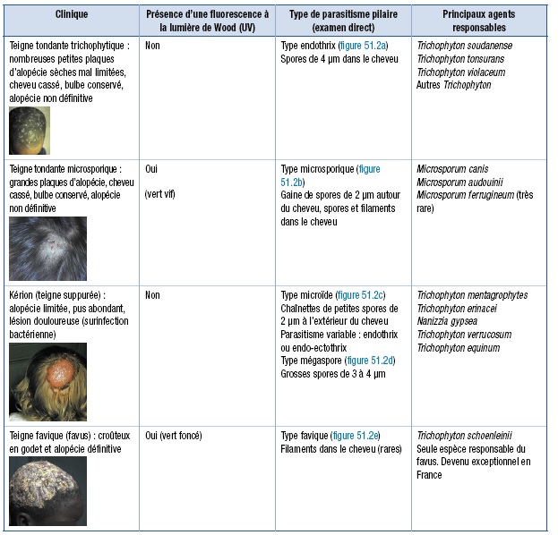 Parasitologie et mycologie médicales