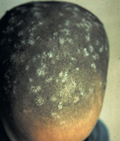 Parasitologie et mycologie médicales