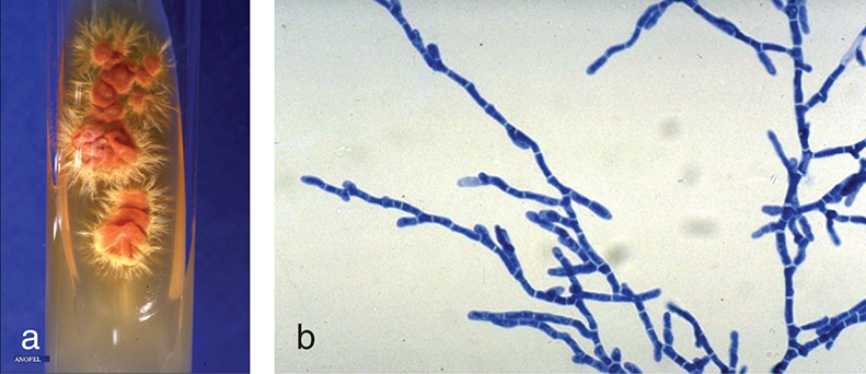 Parasitologie et mycologie médicales
