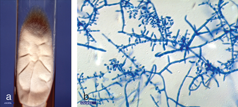 Parasitologie et mycologie médicales