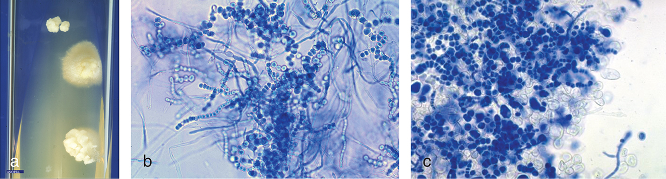 Parasitologie et mycologie médicales