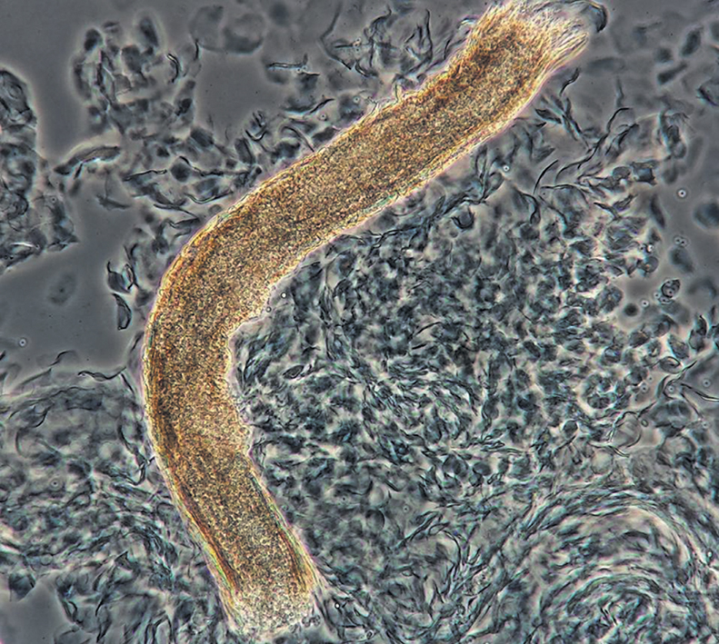 Parasitologie et mycologie médicales