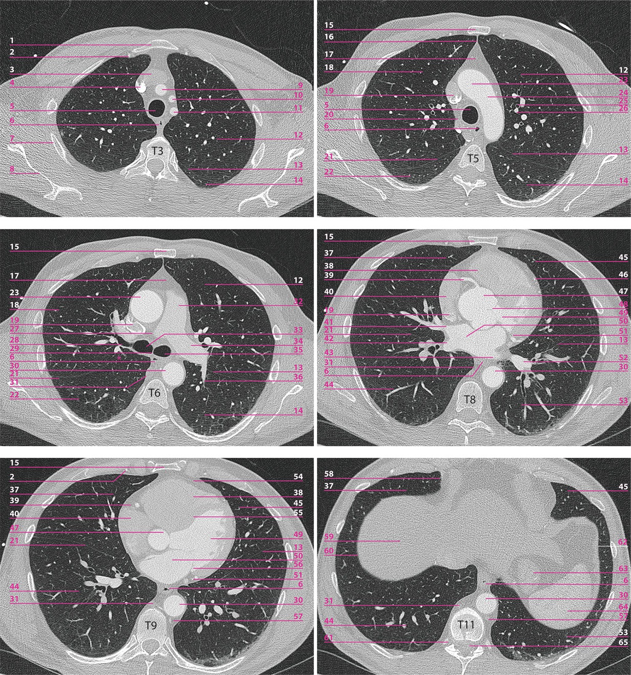 Chapitre 89: Radioanatomie normale