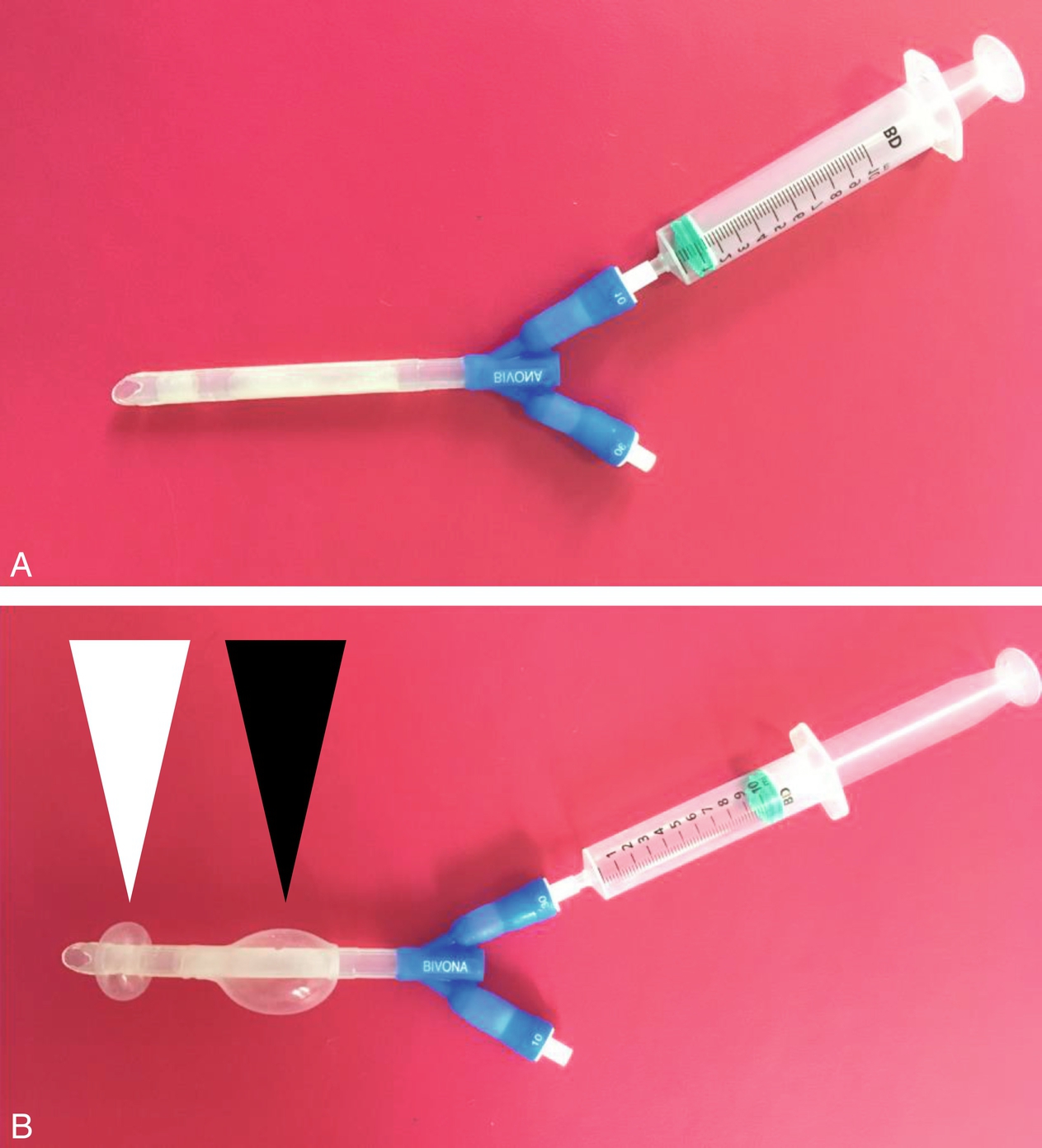 1: ITEM 87 Épistaxis