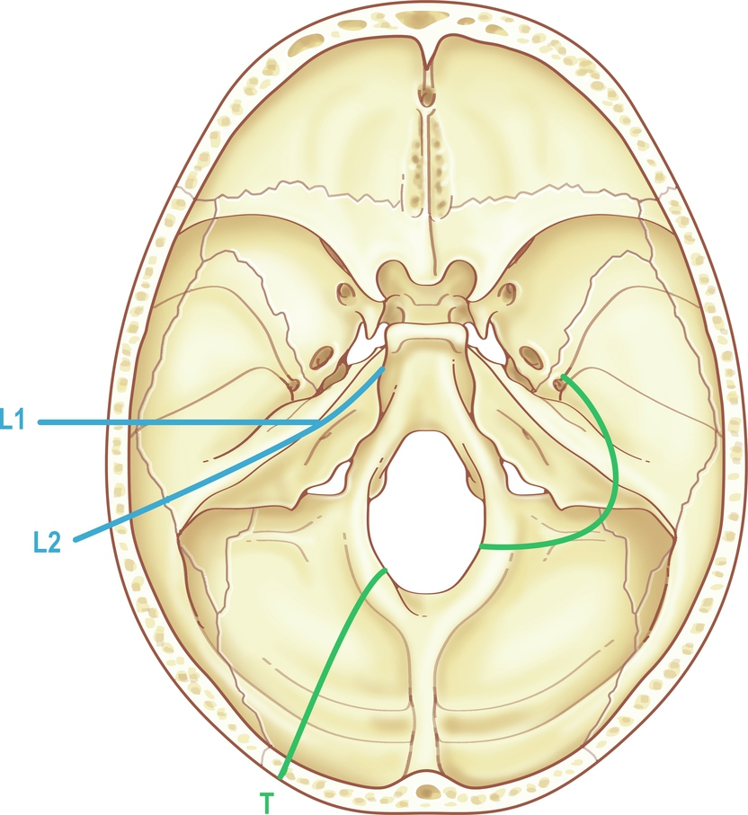 Chapitre 17: ITEMS334, 335 Orientation diagnostique et conduite à tenir ...