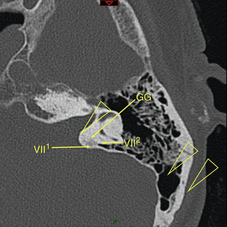 Chapitre 17: ITEMS334, 335 Orientation diagnostique et conduite à tenir ...