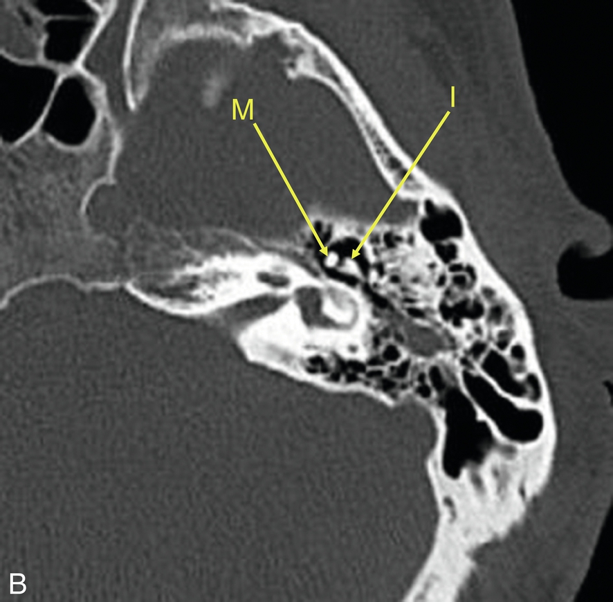 Chapitre 17: ITEMS334, 335 Orientation diagnostique et conduite à tenir ...