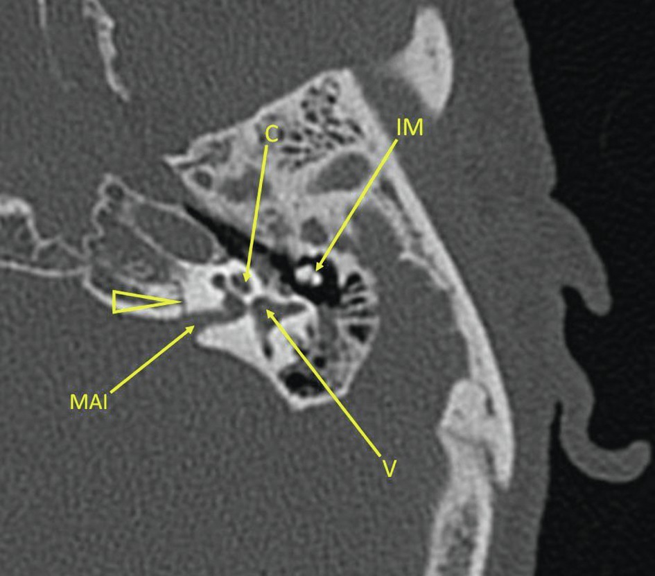Chapitre 17: ITEMS334, 335 Orientation diagnostique et conduite à tenir ...