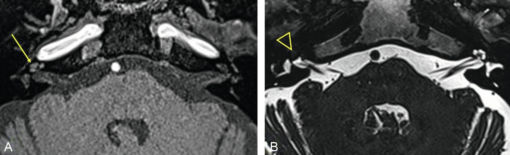 Chapitre 17: ITEMS334, 335 Orientation diagnostique et conduite à tenir ...