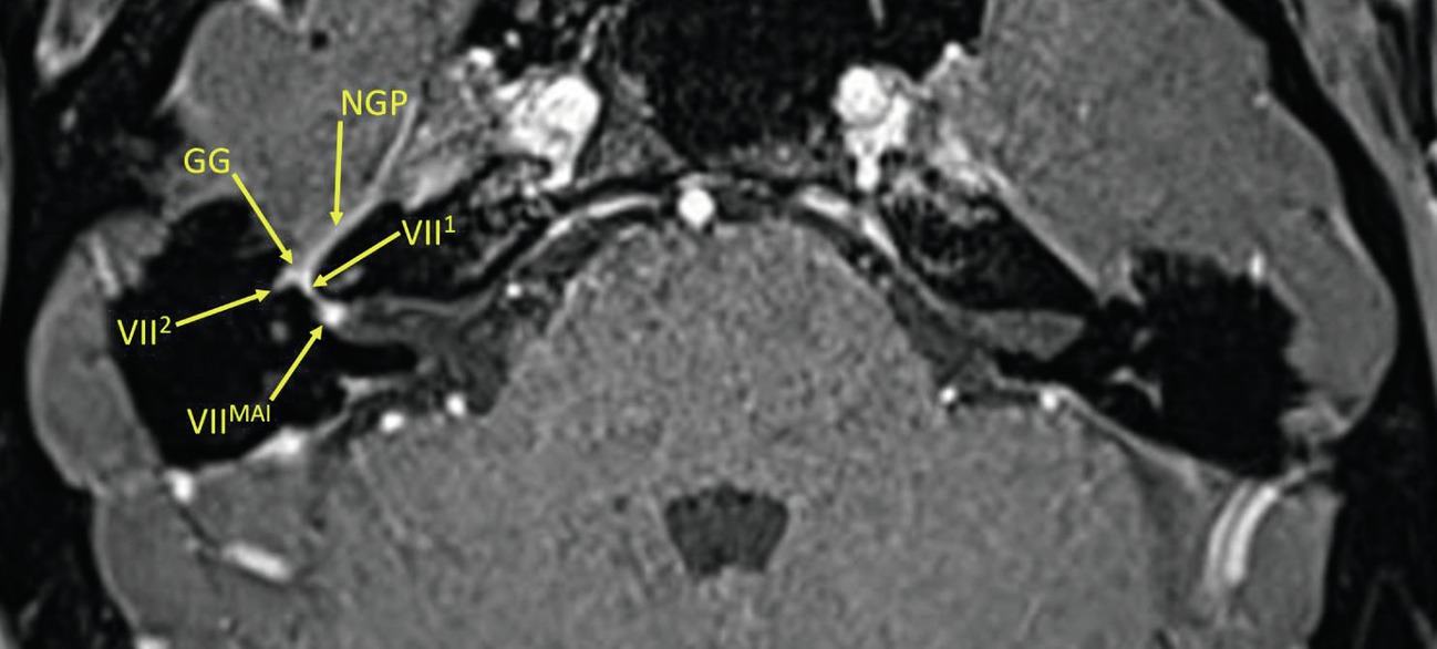 Chapitre 17: ITEMS334, 335 Orientation diagnostique et conduite à tenir ...