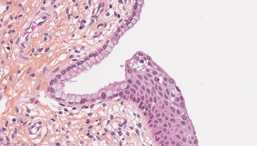 Anatomie et cytologie pathologiques: Rôle clé dans le diagnostic, l ...