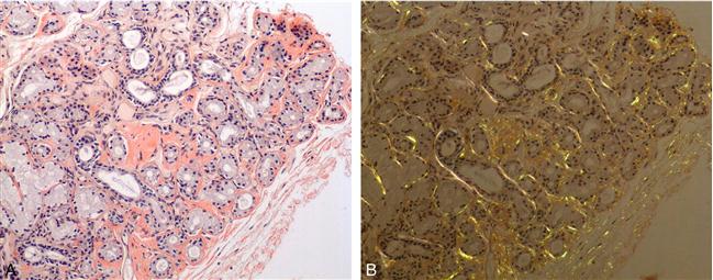 Anatomie pathologique