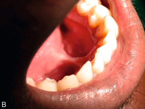 Chirurgie maxillo-faciale et stomatologie