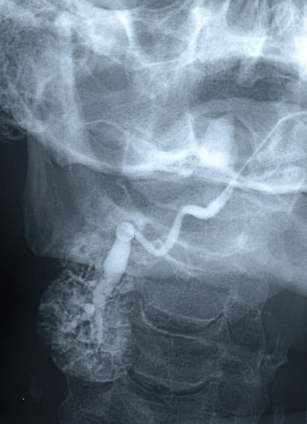 Chirurgie maxillo-faciale et stomatologie