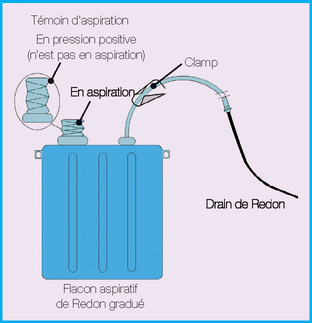 Fiches de soins infirmiers