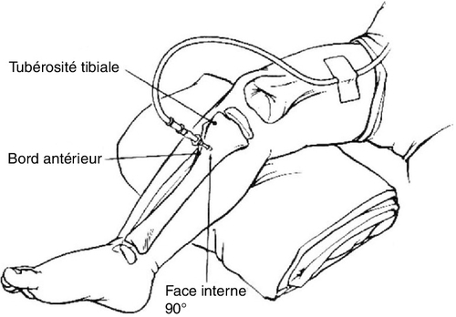 Guide infirmier des urgences