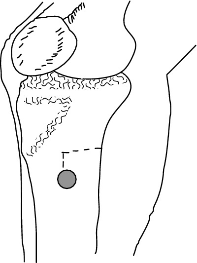 Guide infirmier des urgences